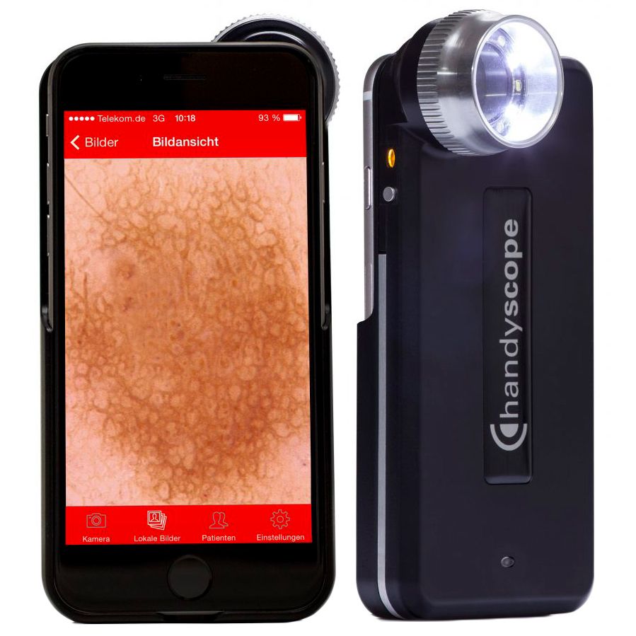 FotoFinder Handyscope NEW Дерматоскоп - купить по лучшей цене у ...